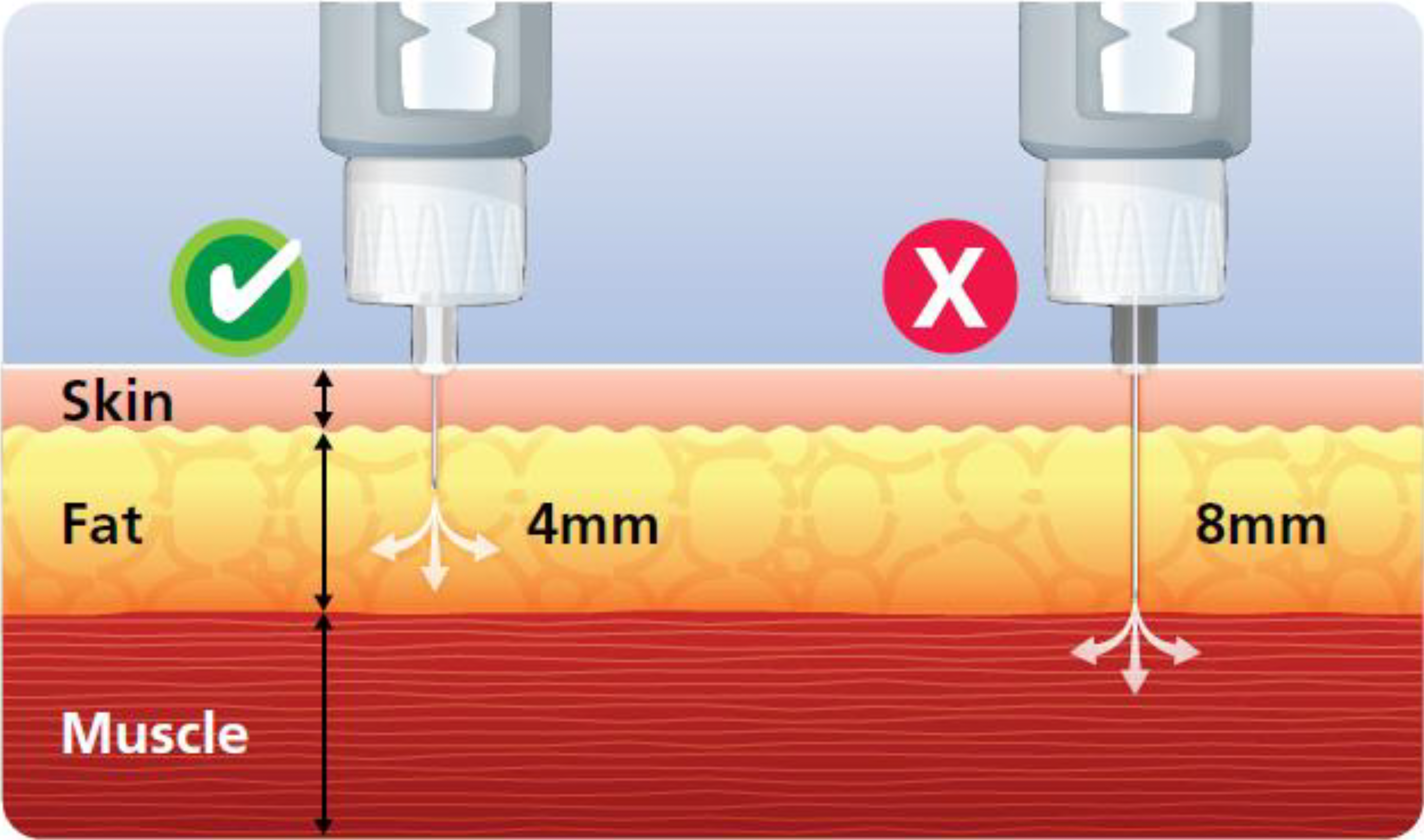 Shift to Short | Embecta Shift to Short Needles - A Pharmacy Guide